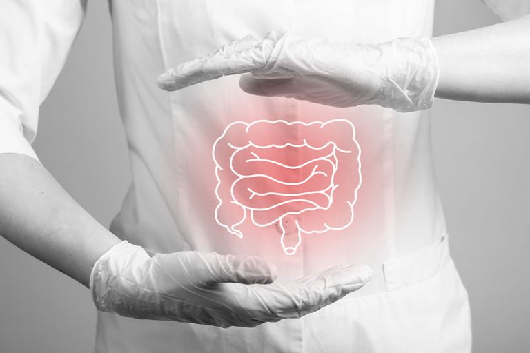 Colectomy at Anatolian Health: Expert Care for Colon Health – Anatolian ...