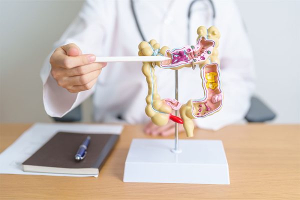 Colectomy at Anatolian Health: Expert Care for Colon Health – Anatolian ...
