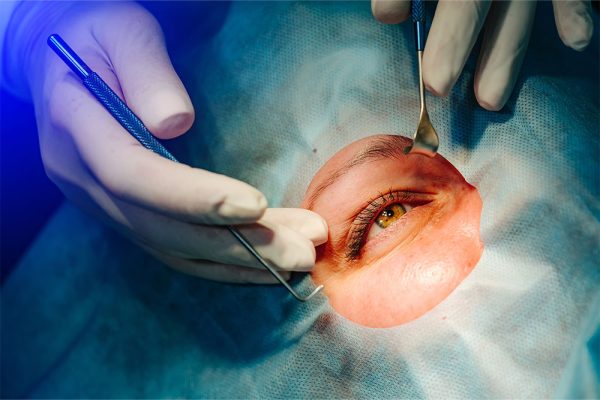 Lens Replacement Surgery at Anatolian Health: A Clear Path to Perfect ...