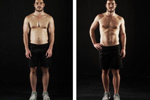 Six Pack Surgery at Anatolian Health: Achieve Defined Abs with Expert ...