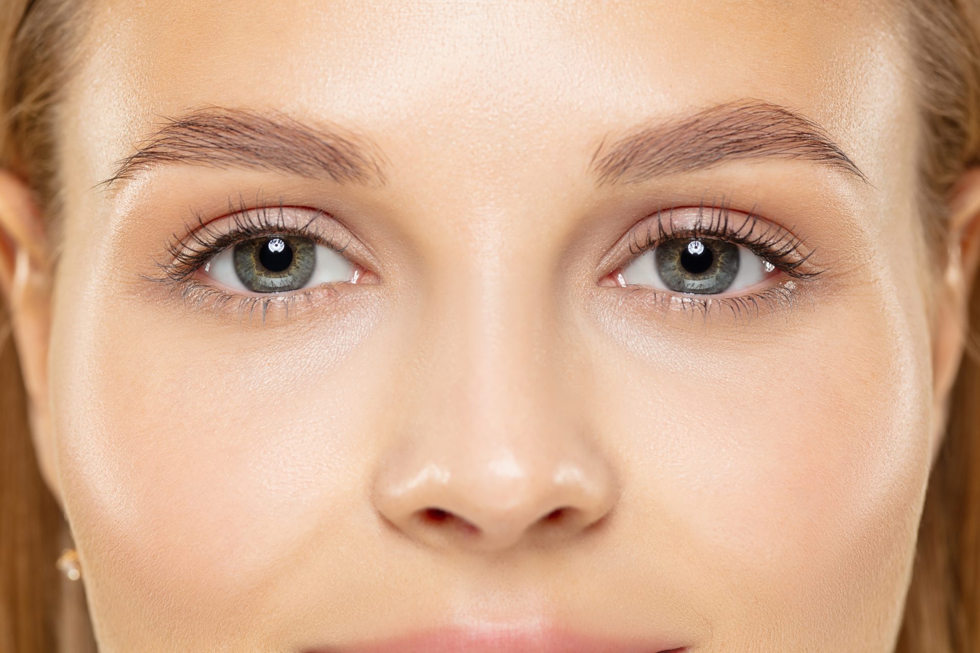 Fox Eye Surgery at Anatolian Health: Elevate Your Beauty with a ...